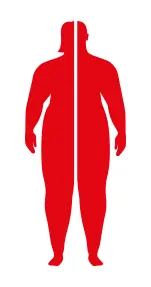 Adipositas – Ihr Weg zu einem gesünderen Leben | Zur Rose